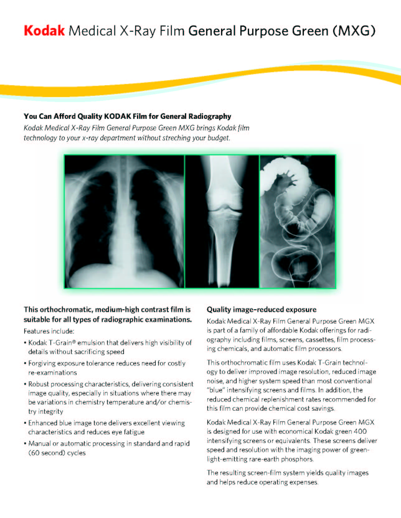 Medical_X-ray_Film_General_Purpose _Green_(MXG) 1 _1 | TI-BA Enterprises