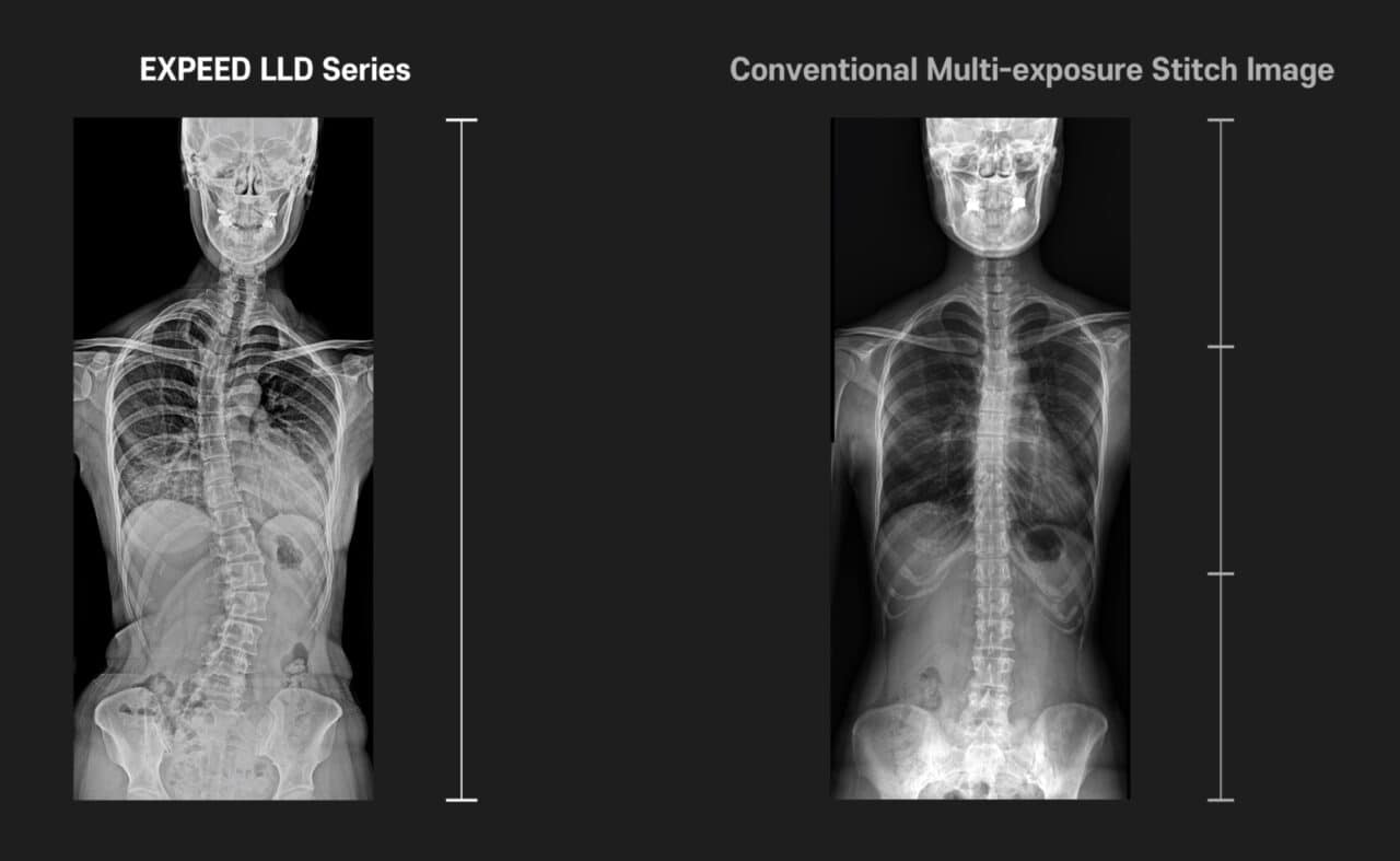 EXPEED Long-Length DR System | TI-BA Enterprises