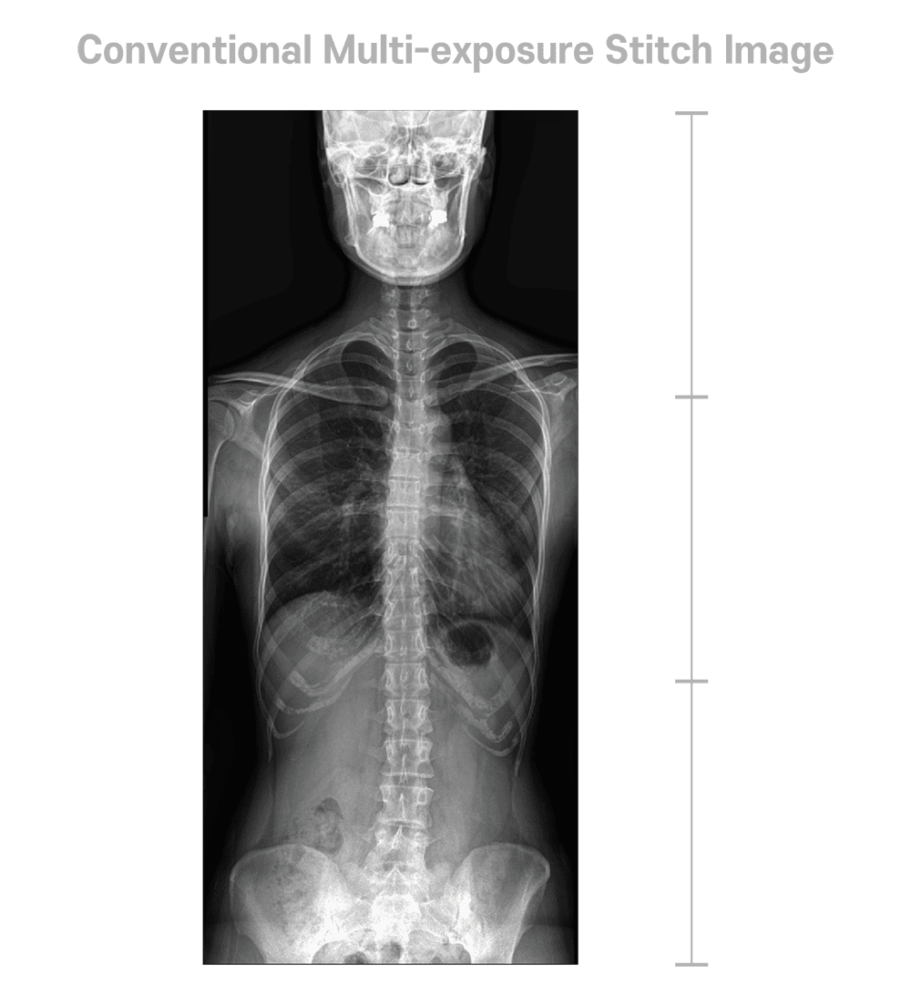 long view single shot imaging conventional 1000 수정 21649 | TI-BA ...