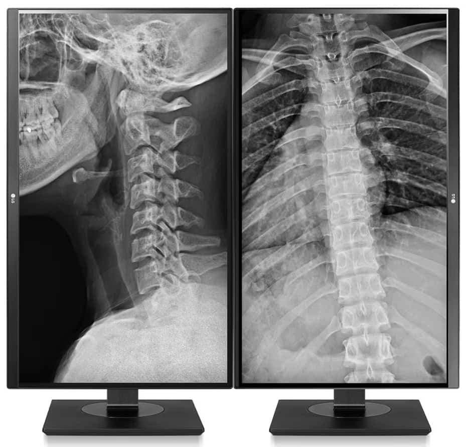 Digital X-ray Imaging | TI-BA Enterprises | DR Systems